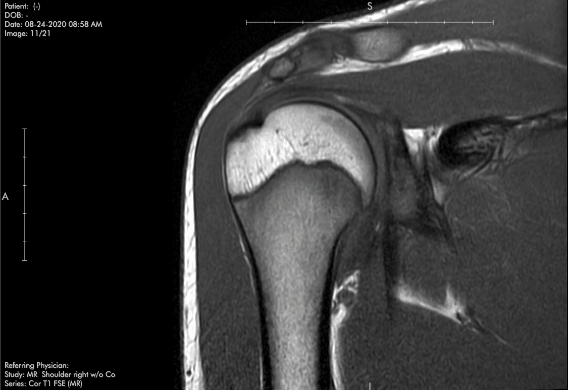 Shoulder MRI Online Fellowship Certificate - MSK Course