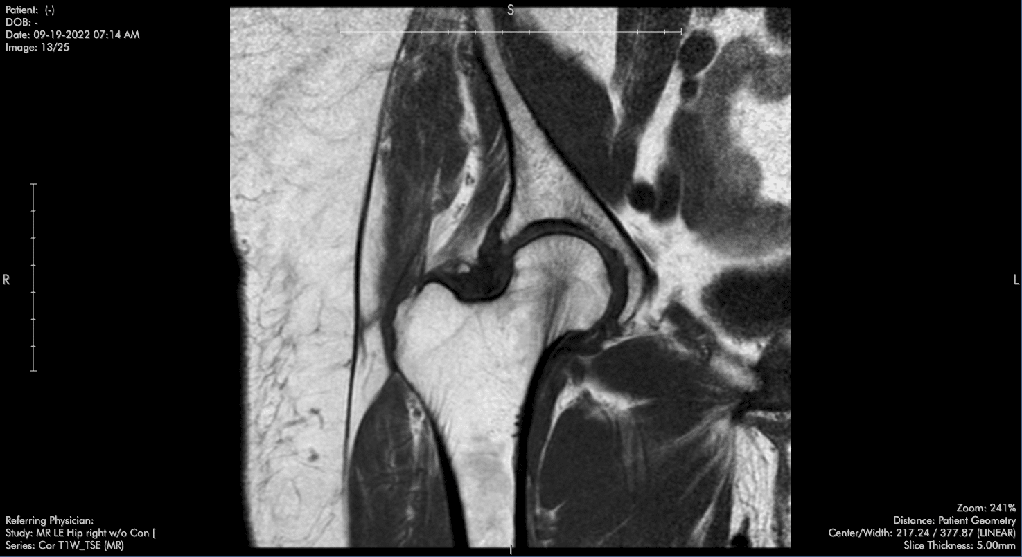 Hip MRI Fellowship Certificate - Musculoskeletal Imaging Fellowship ...