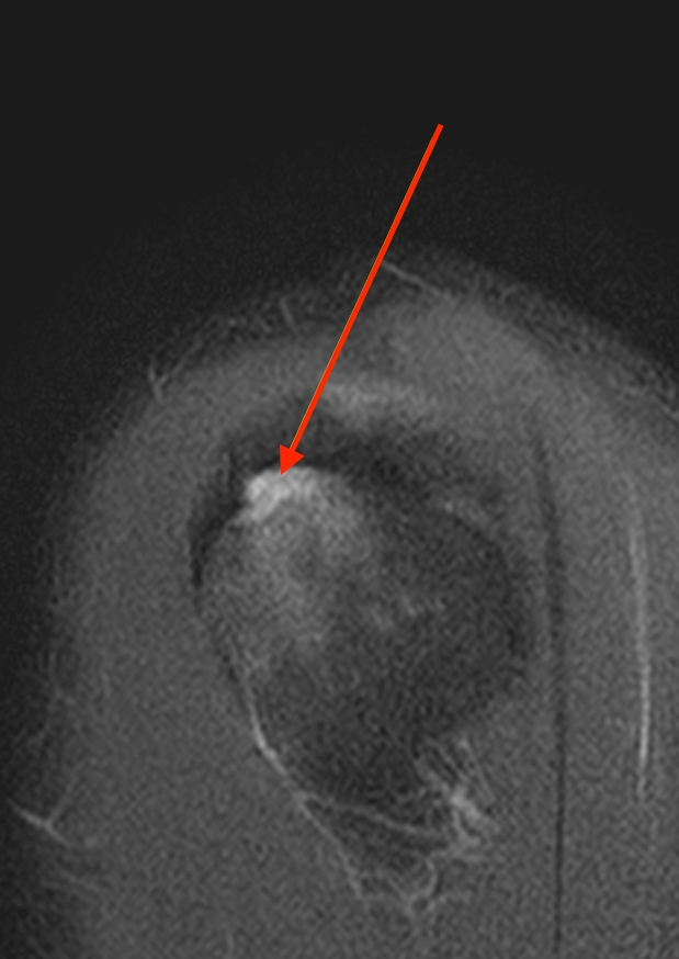 2023 MSK Radiology Conference with Dr. Don Resnick & Dr. Stephen Pomeranz